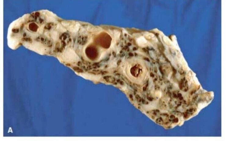 Eurytrema pancreaticum em bovinos: saiba mais sobre esse parasita